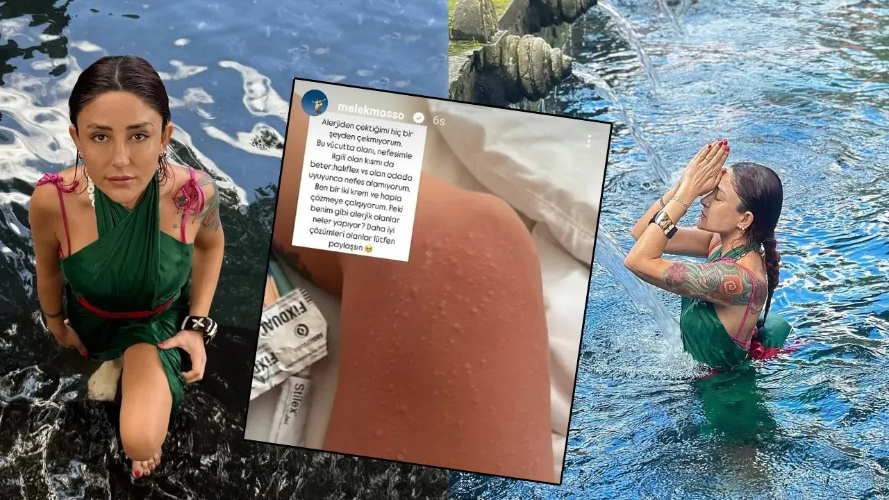 Melek Mosso'nun Hastalığı Ne? Bali Belly Nedir, Belirtileri Nelerdir ...